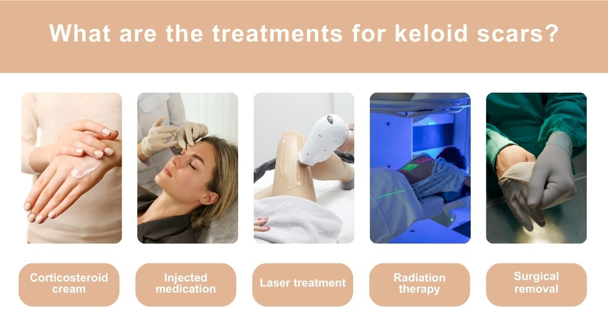 How To Heal Keloid Scars: Effective Strategies For Fast Healing