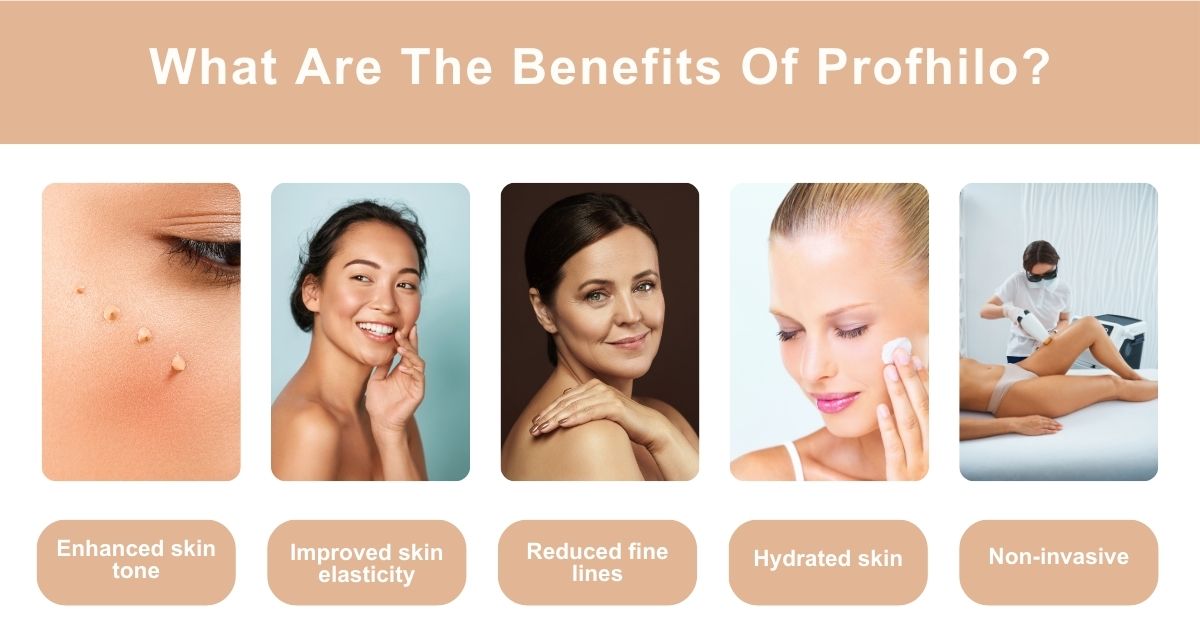 Profhilo Treatment Price In Dubai: Affordable Options