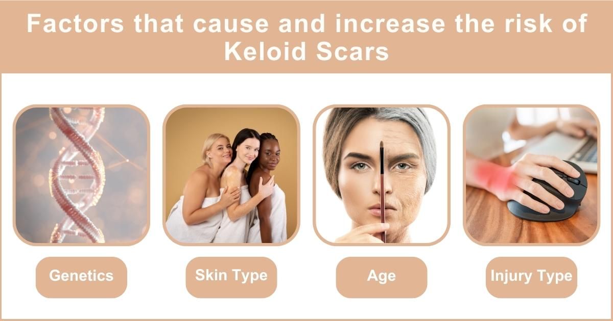 Keloid Scar Revision Surgery: Essential Insights | Best Female Plastic Surgeon In Dubai Dr ...