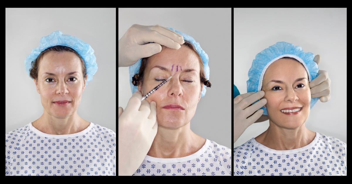 Your Guide To Botox Eyebrow Lifting | Best Female Plastic Surgeon In ...