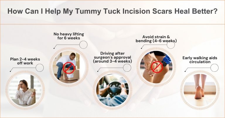 Tummy Tuck In The Elderly: A Guide To Safe And Effective Procedures ...