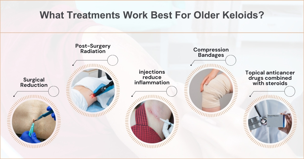 Can Old Keloid Scars Be Removed | Best Female Plastic Surgeon In Dubai Dr Shehzadi Tasneem